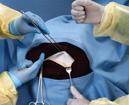 MamaBirthie CS - Birthing and safe c-section simulator | Laerdal Global ...